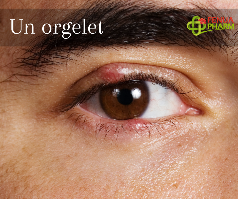 Un orgelet – GIE Fenua Pharm